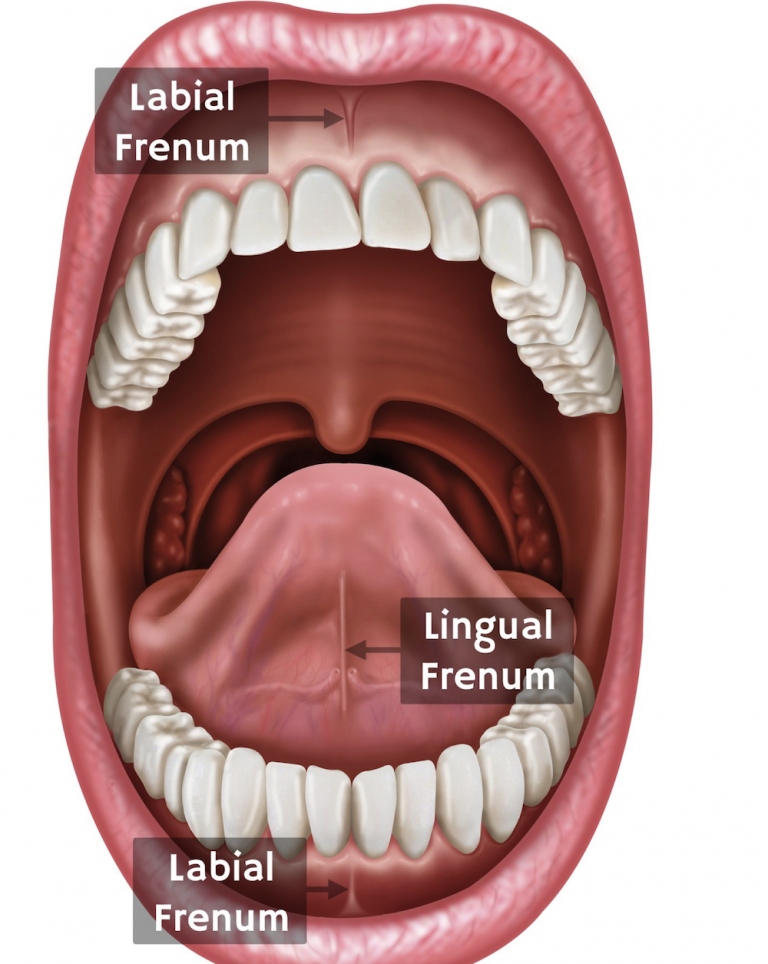 Benefits Of Tongue Tie And Lip Tie Laser Surgery Lonestar Kid S Dentistry