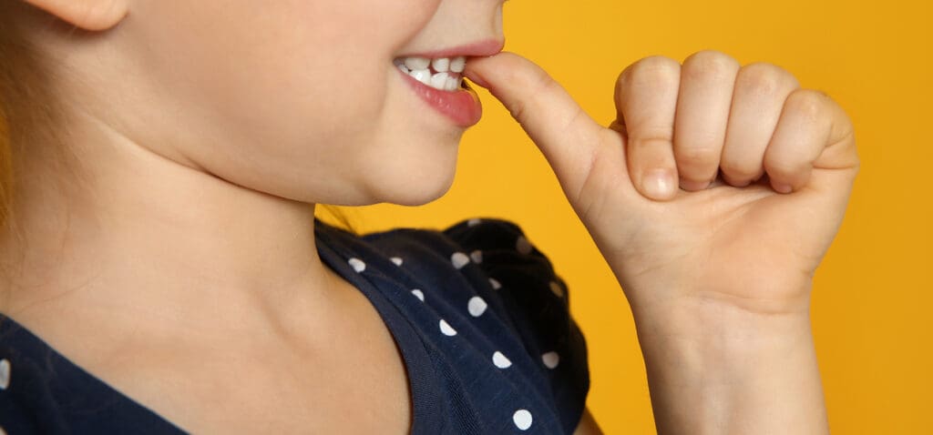 Craze lines | Cracked tooth | Pediatric dentist in McKinney TX